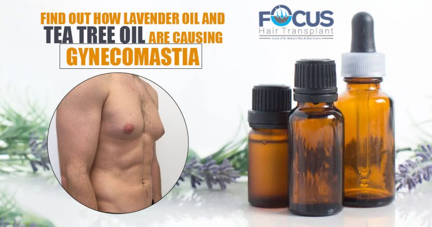 Find Out How Lavender Oil and Tea Tree Oil Are Causing Gynecomastia