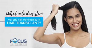 Role of stem cells and hair cloning in hair transplant?